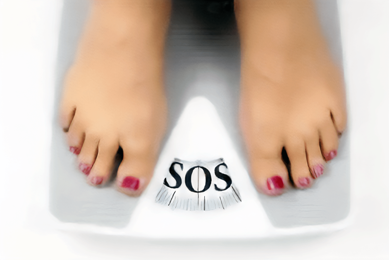 Severe Obesity: Understanding, Causes, and Management - Body Mass Index